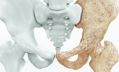 Prolia (Denosumab): El mejor tratamiento para la osteoporosis